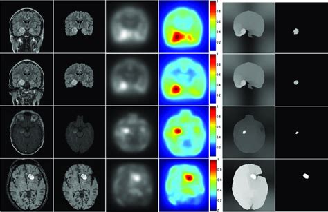 Segmentation Results From Left To Right Input Image Brain Tissue Download Scientific