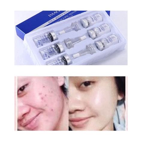 Essence Ampul Serbuk Beku Memperbaiki Kulit Dengan Cepat Shopee Malaysia