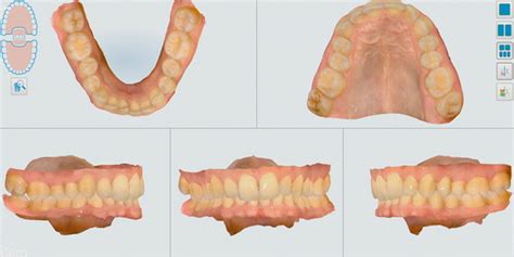 New Itero Lumina Reviewed