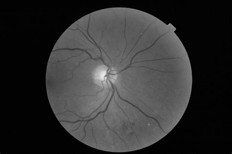 Getting Different Results From Matlab Opencv