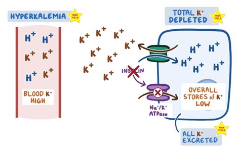 Study Tips Usmle® Step 2 Ck Question Of The Day Diabetic Ketoacidosis