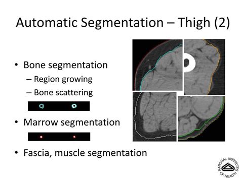 Ppt Automated Segmentation Of Computed Tomography Images Powerpoint Presentation Id 4356888