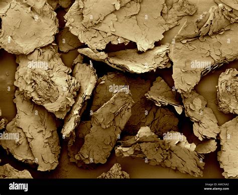 Dandruff Flakes Under Microscope