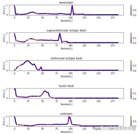 机械故障诊断代理模型的案例分析（可解释性，shap方法） 知乎