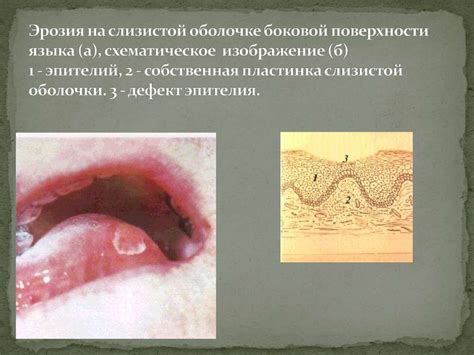 Слизистая оболочка полости рта презентация онлайн