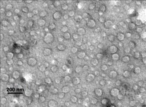 Transmission Electron Microscopy Of Optimized Nanostructured Lipid Download Scientific Diagram