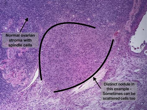 Histology Lesson Distinct Collection Of Hilus Hilar Cells In Ovary