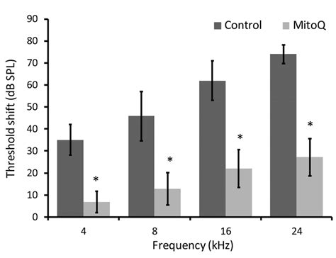 Auditory Brainstem Response Threshold Shifts 3 To 4 Days After Download Scientific Diagram