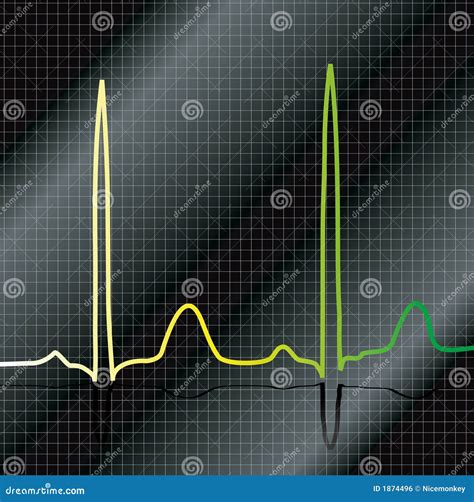 Gradient Ecg Stock Illustration Illustration Of Chart 1874496