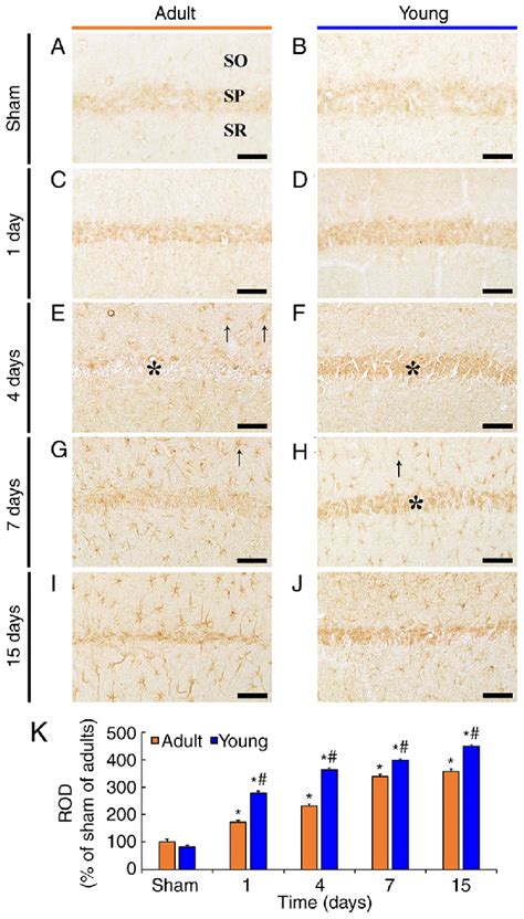Tnf α Immunohistochemistry A J Tnf α Immunohistochemistry In The Ca1 Download Scientific