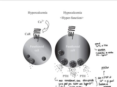 2 Hypo Hyperparathyroidie Karteikarten Quizlet