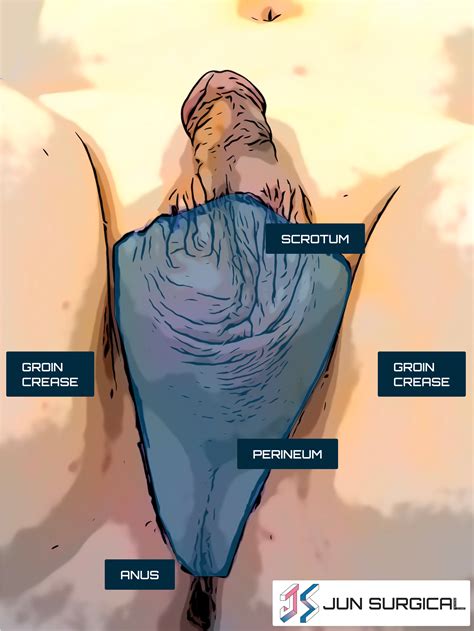 Hair Removal Jun Surgical