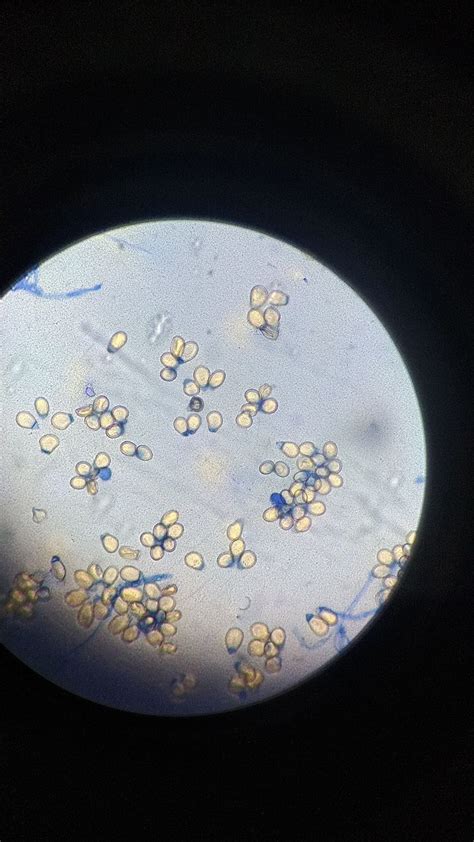 LPCB Staining Fungi