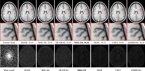 Figure 1 From Memory Efficient Model Based Deep Learning With Convergence And Robustness