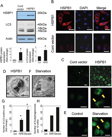 Lc3 Expression Is Increased By The Overexpression Of Hspb1 In Nrk Lc3 Download Scientific