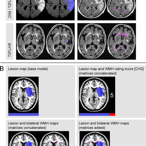 Lesion Segmentation And Model Versions Download Scientific Diagram