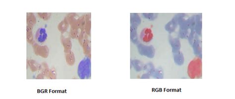 noise removal from morphological operations in image processing… towards ai
