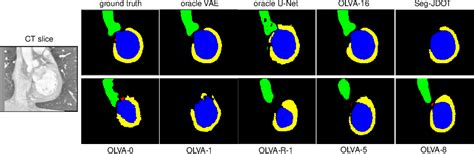 optimal latent vector alignment for unsupervised domain adaptation in