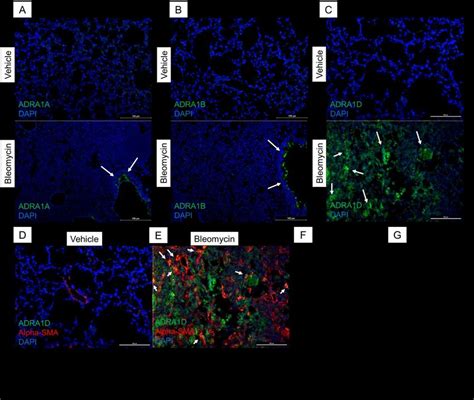 Geospatial Localization Of Cells Expressing Adra1d And Sma In