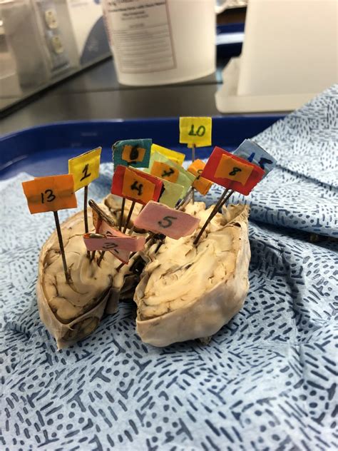 Sheep Brain Sagittal 2 Diagram Quizlet Sheep Brain Sagittal 2 Diagram Quizlet