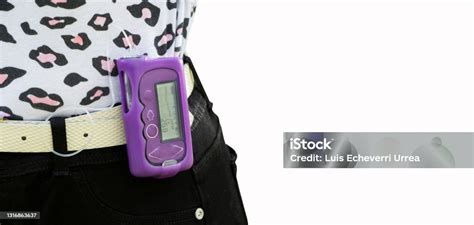 그녀의 다리에 연결된 인슐린 펌프와 당뇨병 소녀 당뇨병에 대한 스톡 사진 및 기타 이미지 당뇨병 인슐린 복부 Istock
