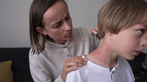 Symptoms Of Photodermatitis Mom Noticed A Rash On The Boy S Neck
