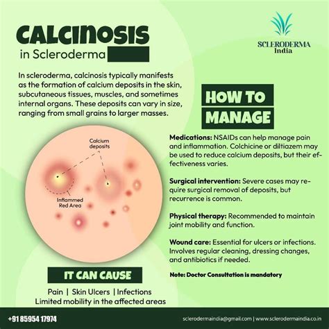 Scleroderma India On Linkedin Sclerodermaindia Scleroderma