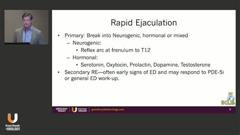 Managing The Man With Ejaculatory Dysfunction Excel Male Trt Forum