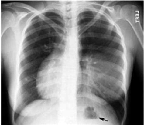 Variation In Bit Error Rate BER Versus Signal To Noise Ratio SNR
