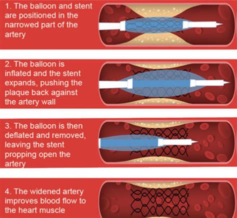 Lecture 2 Flashcards Quizlet