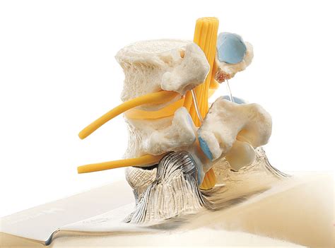 Intervertebral Disc Model Adamrouilly