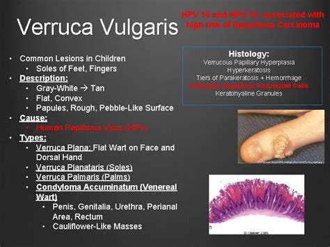Skin Pathology Iii Pemphigus Vulgaris Type Ii Hypersensitivity