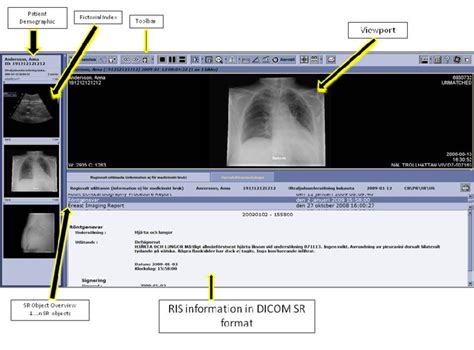 Presentation Of Dicom Objects With A Ge Dicom Viewer Download Scientific Diagram