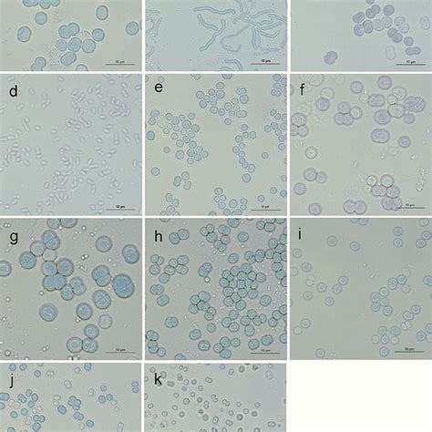 Microphotographs Of Synechocystis Strains At 1000× Magnification A