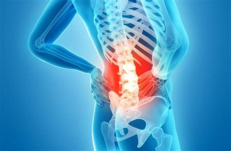 Лордоз позвоночника причины симптомы и лечение Заболевания позвоночника