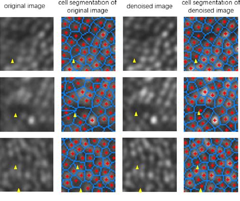 figure 8 from semi supervised generative adversarial learning for