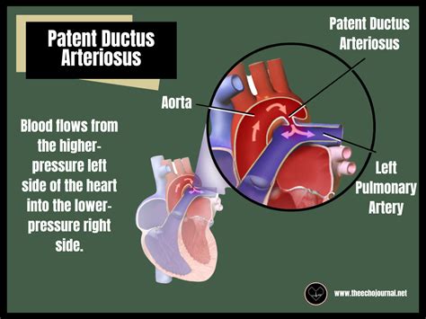 Pda Seeing The Flow By Alex C The Echo Journal