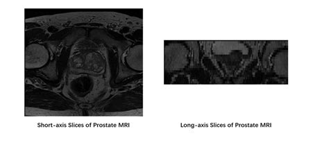 Examples Of Short Axis Slices And Long Axis Slices For Anisotropic