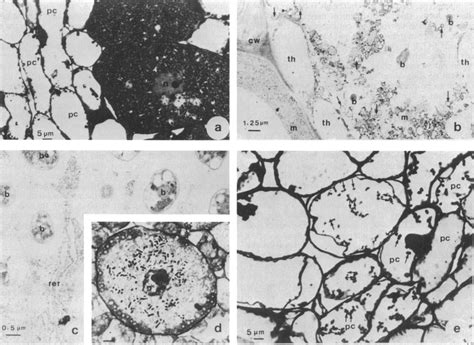 A Cross Section Of The Wild Type Root Nodule Of Soybean Induced By R