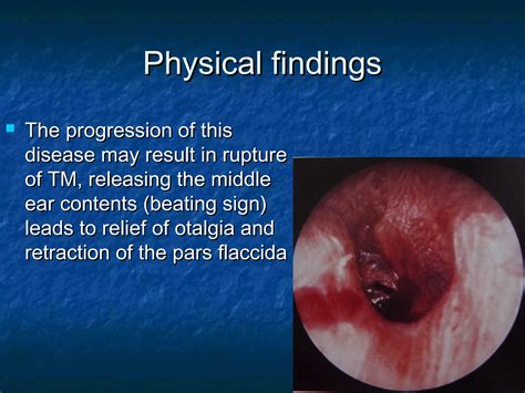 Acute Otitis Media And Mastoiditis Ppt