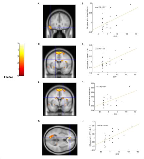 Voxel Wise Regression Results Depicting Positive Relationships