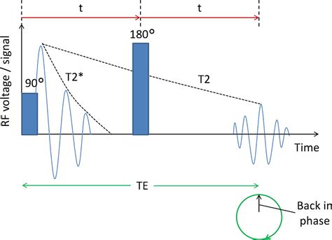 Spin Echo Sequence Radiology Cafe