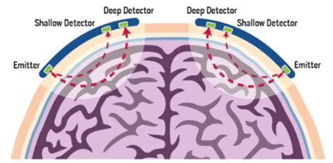 Cerebral Oximetry—an Introduction Virtual Library
