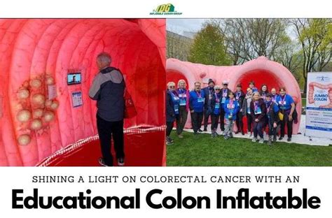 Prevent Colorectal Cancer With An Educational Colon Inflatable