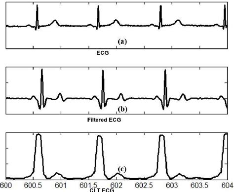 Figure 1 From Adaptive Ecg Interval Extraction Semantic Scholar