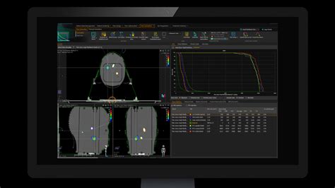 Ruby Modular Qa Phantoms Ptw Ruby Modular Qa Phantoms Ptw