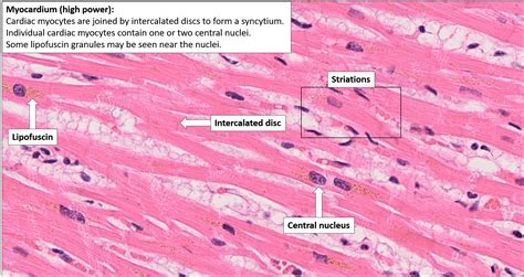 Heart Normal Histology Nus Pathweb Nus Pathweb