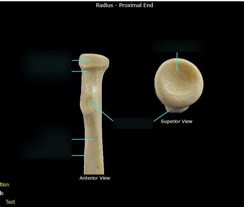 Radius Proximal End Diagram Quizlet