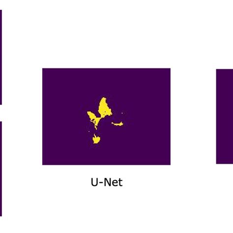 4 segmentation results for a image slice near the neck of femur