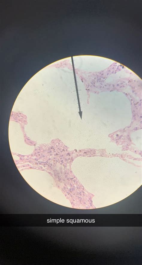 Simple Squamous